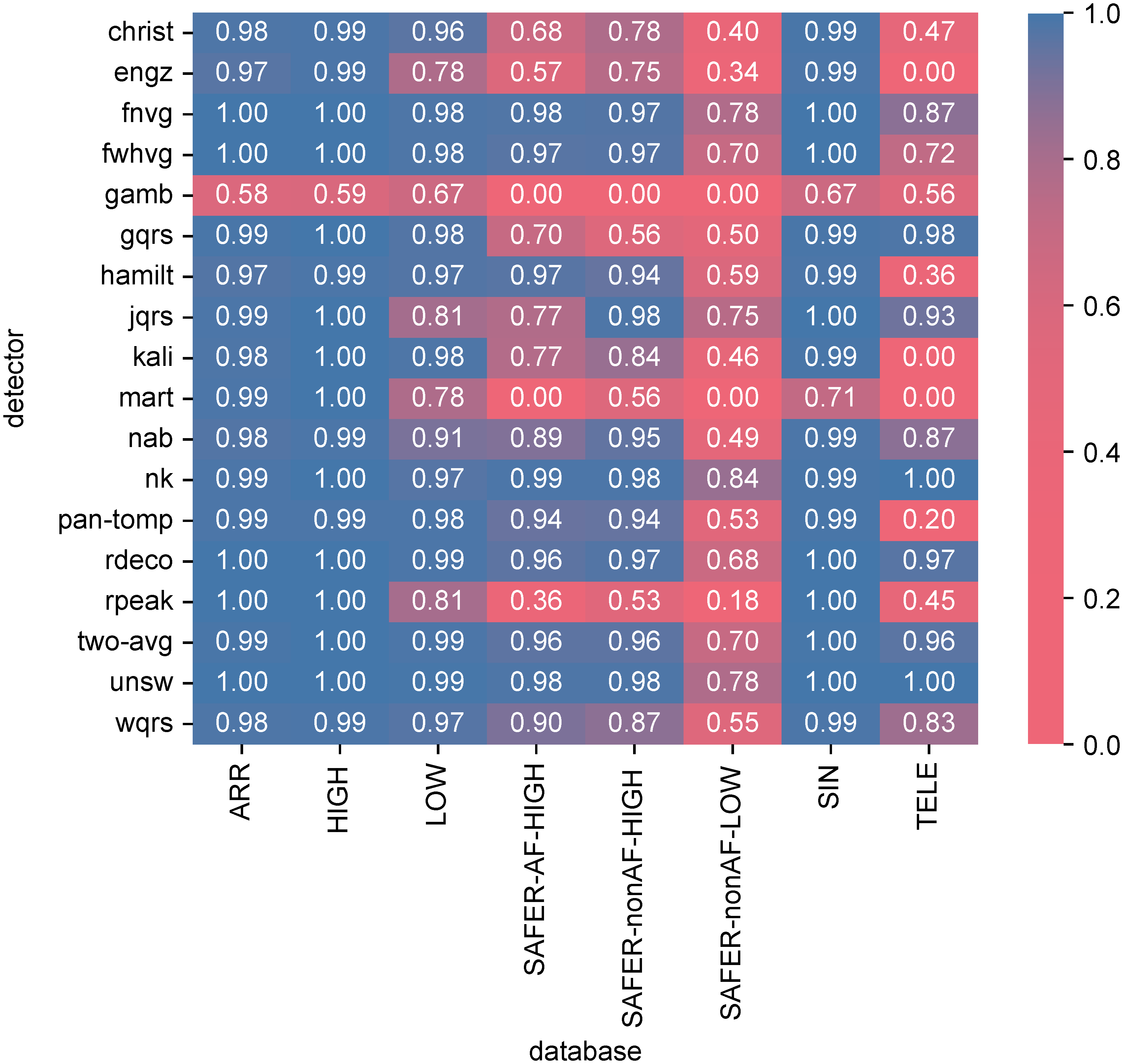 QRS detection in single-lead, telehealth electrocardiogram signals ...