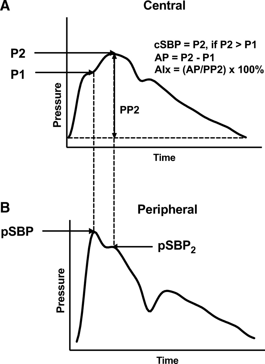 Relationship between fiducial points on the peripheral and central ...