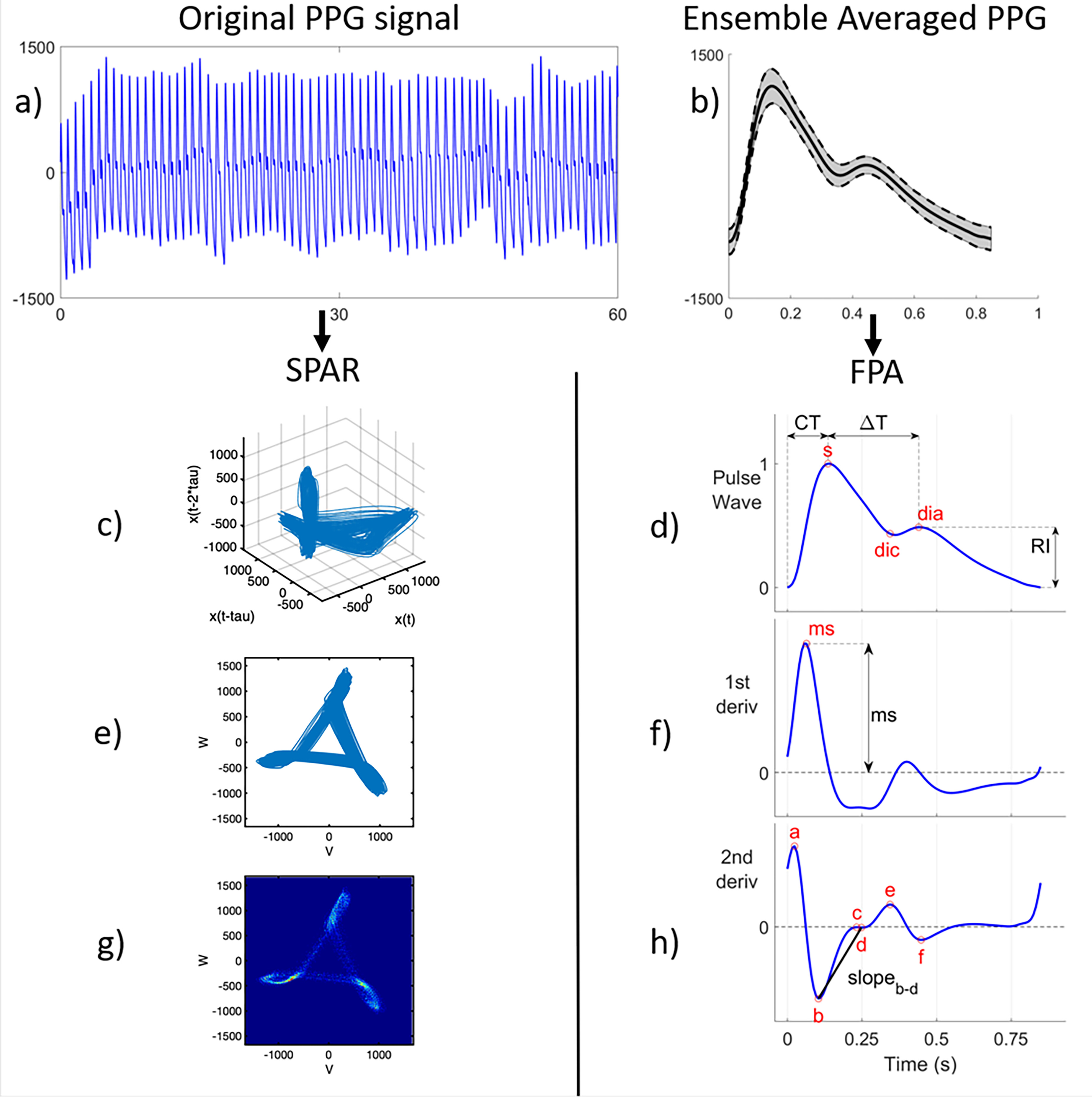 Advanced waveform analysis of the photoplethysmogram signal using ...