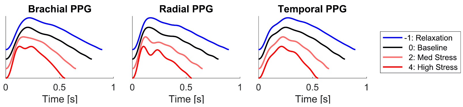 Assessing mental stress from the photoplethysmogram: a numerical study ...
