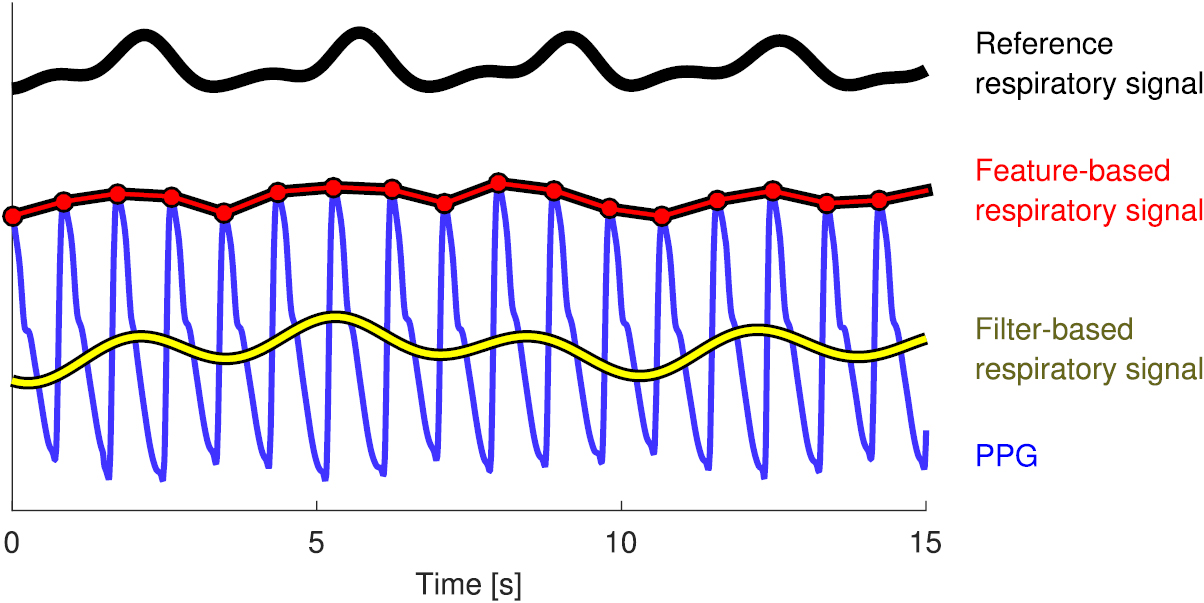 Extraction of respiratory signals from the electrocardiogram and photoplethysmogram: technical ...