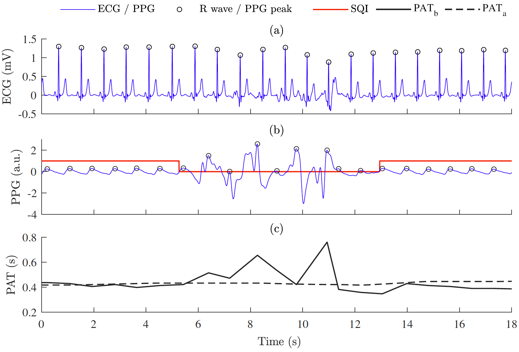 Influence of Photoplethysmogram Signal Quality on Pulse Arrival Time ...