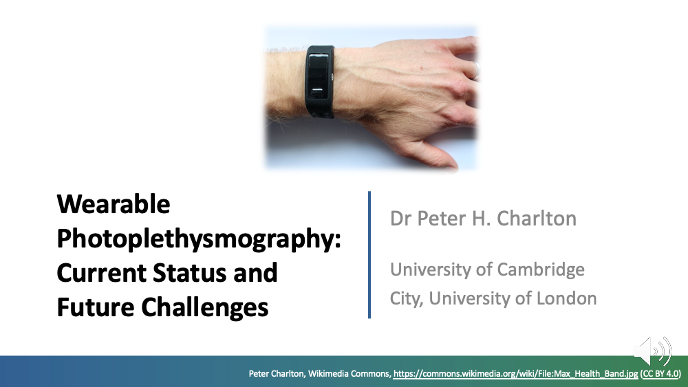 Accelerometry-Guided Inter-Beat-Interval Assessment from Wrist ...
