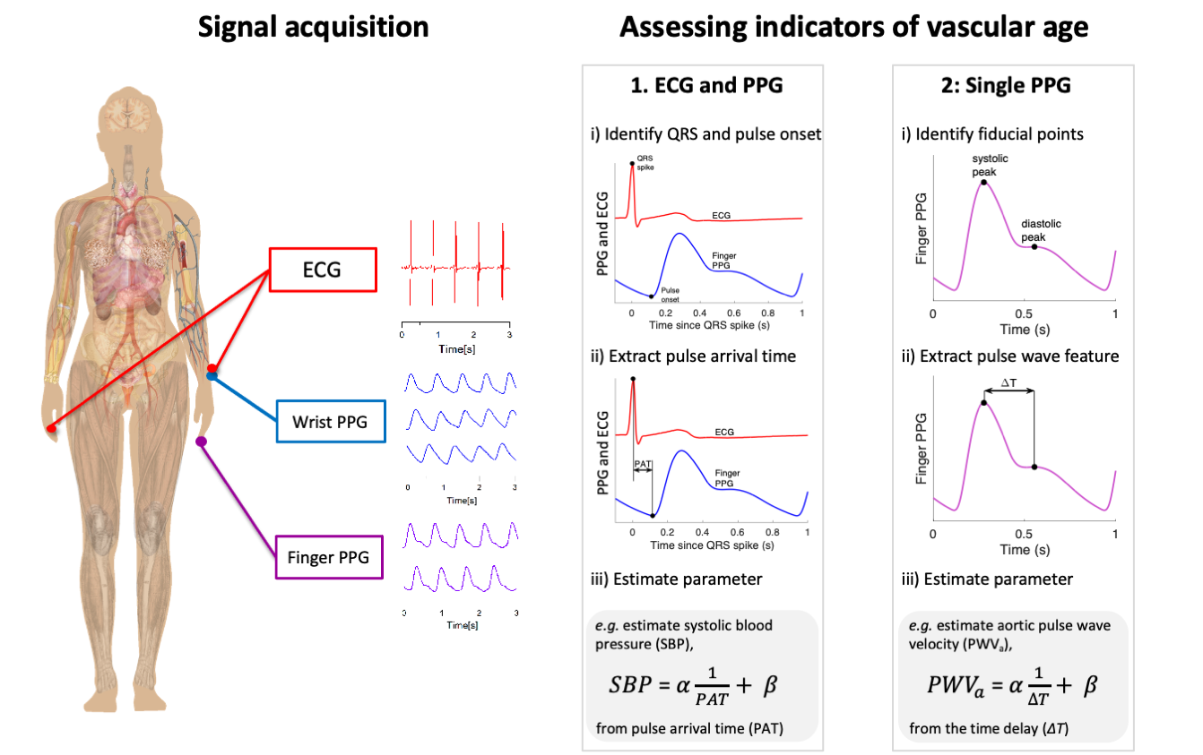Analysing cardiovascular signals to assess vascular age | Peter Charlton